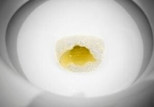 What Does My Pee Color Mean? Most Popular 9 Types of Pee